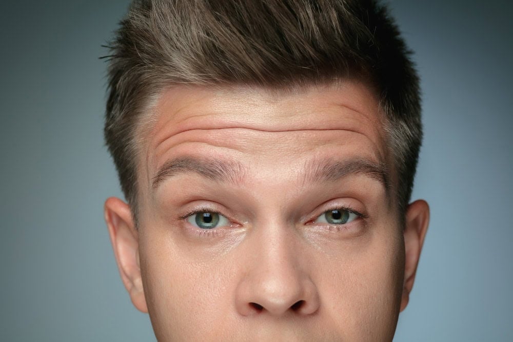 Forehead Wrinkle Reduction with Botox at Siam Clinic Phuket - Siam ...