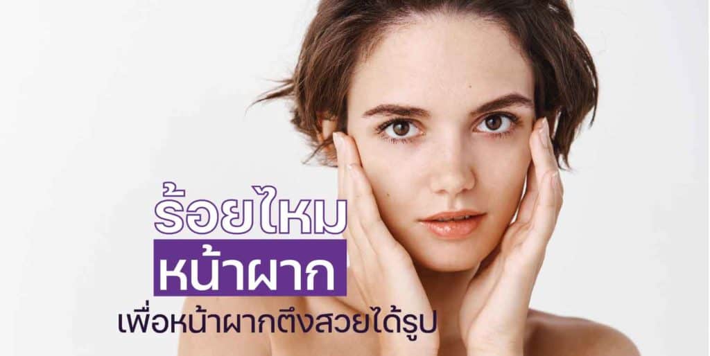 Thread Lifting at Forehead - Siam Clinic - Aesthetic & Wellness Clinic ...