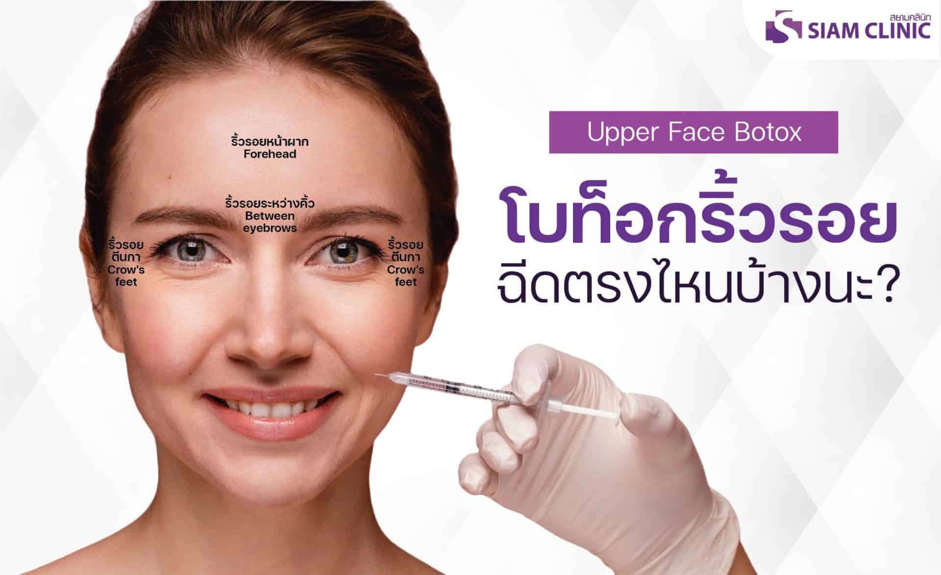 รีวิวเคสฉีดโบท็อก - Siam Clinic Phuket คลินิกความงามภูเก็ต