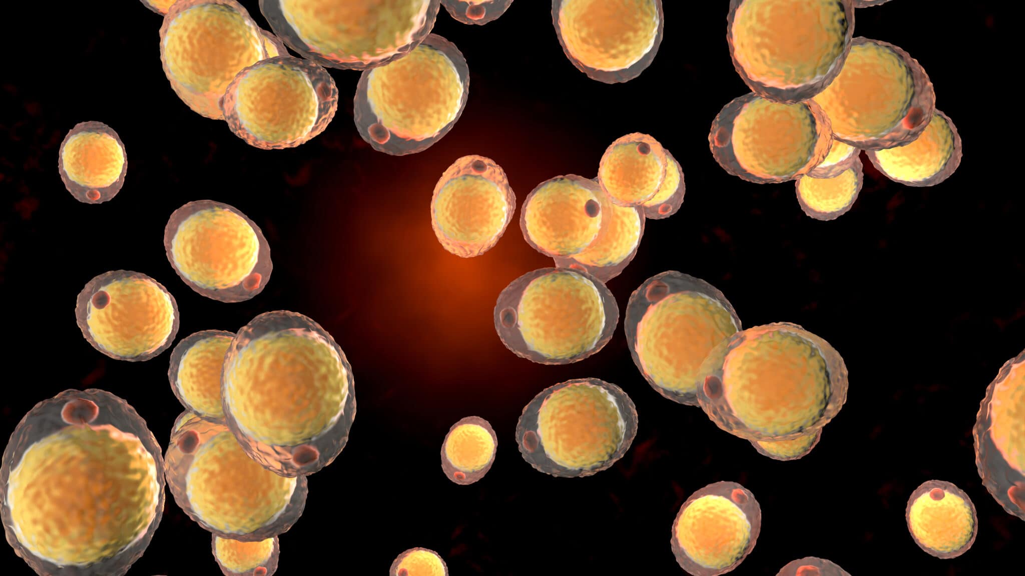 Liposuction - Siam Clinic - Aesthetic & Wellness Clinic in Phuket