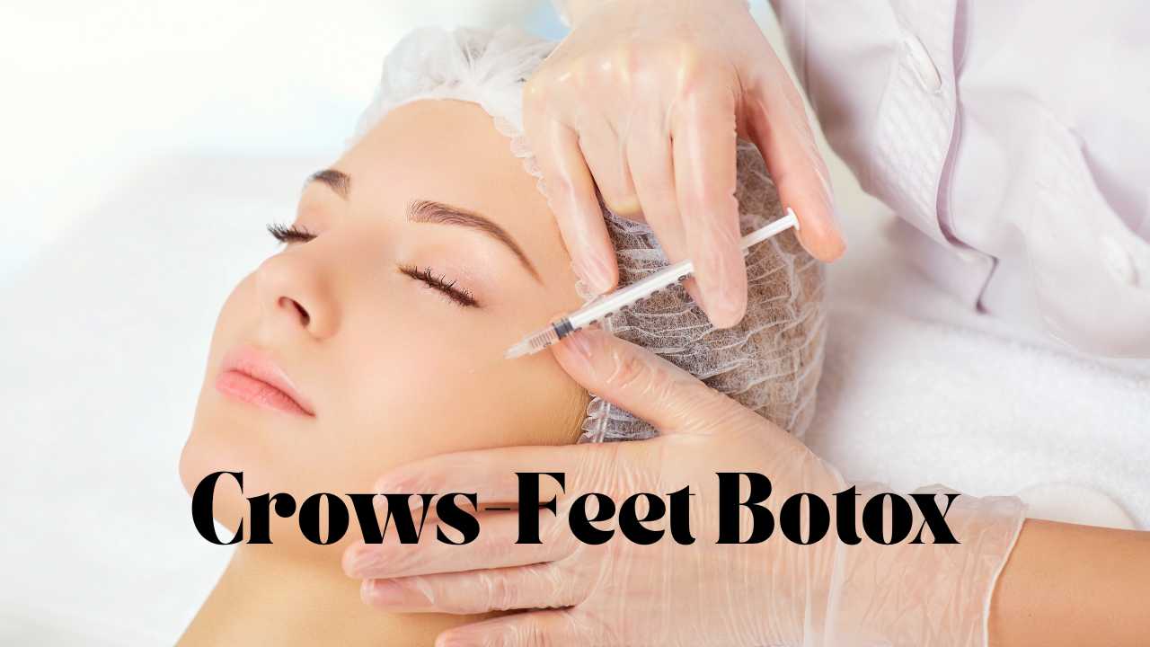 Crows Feet Botox: Say Goodbye to Smile Lines Around Your Eyes - Siam ...